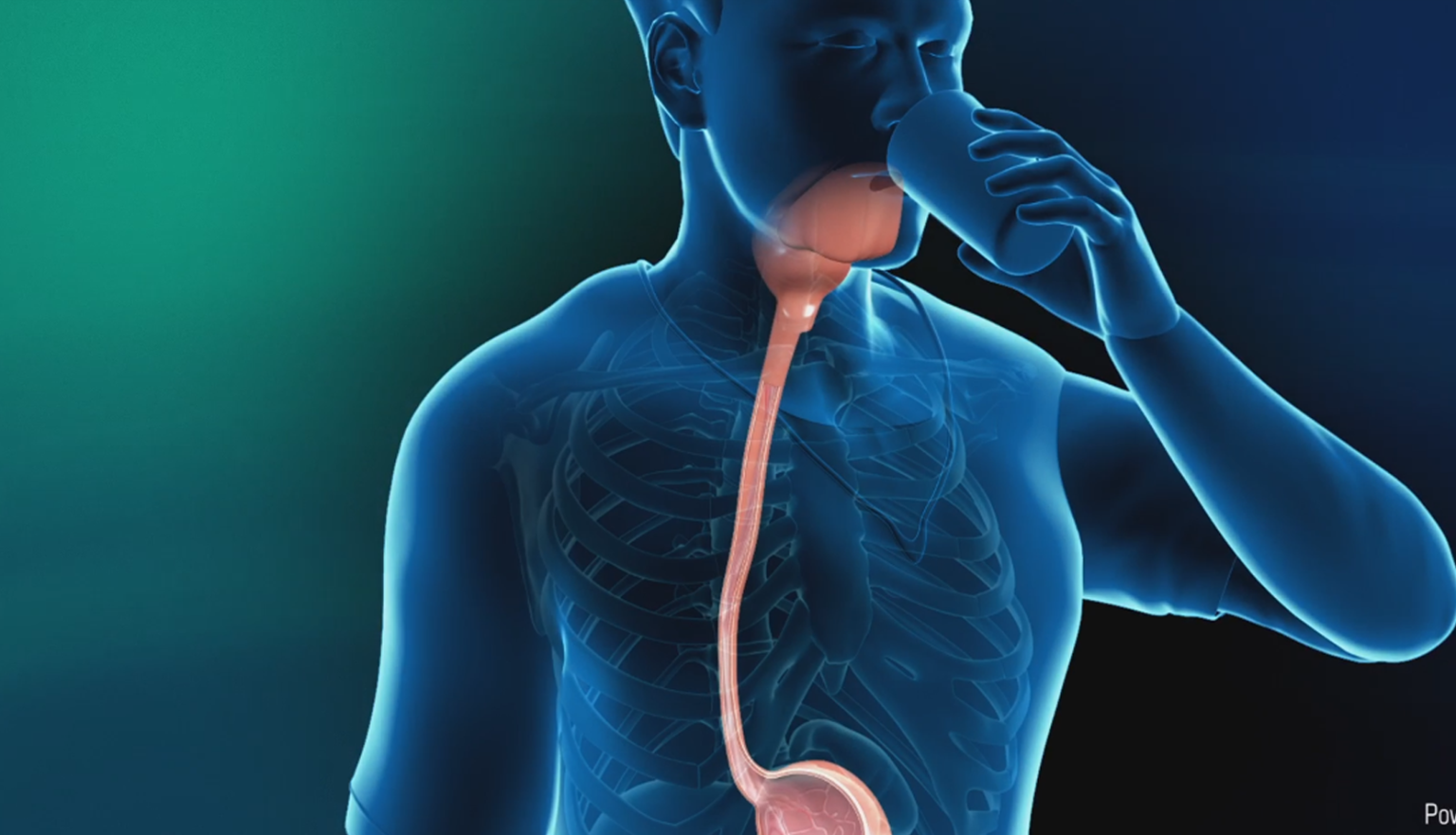 Barium Study – MSDC